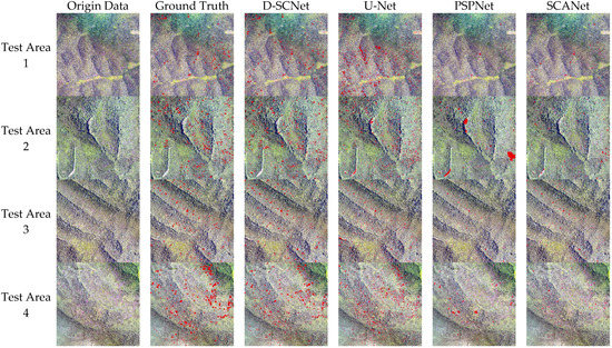 Recognition of Abnormal Individuals Based on Lightweight Deep Learning ...