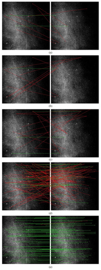 A Registration Algorithm for Astronomical Images Based on Geometric ...