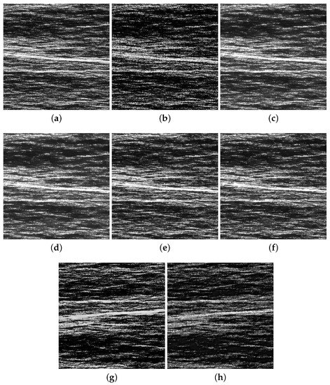 Despeckling of SAR Images Using Residual Twin CNN and Multi-Resolution ...
