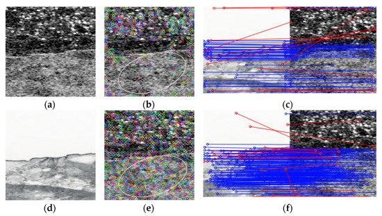 Remote Sensing | Free Full-Text | SAR and Optical Image Registration Based on Deep Learning with ...