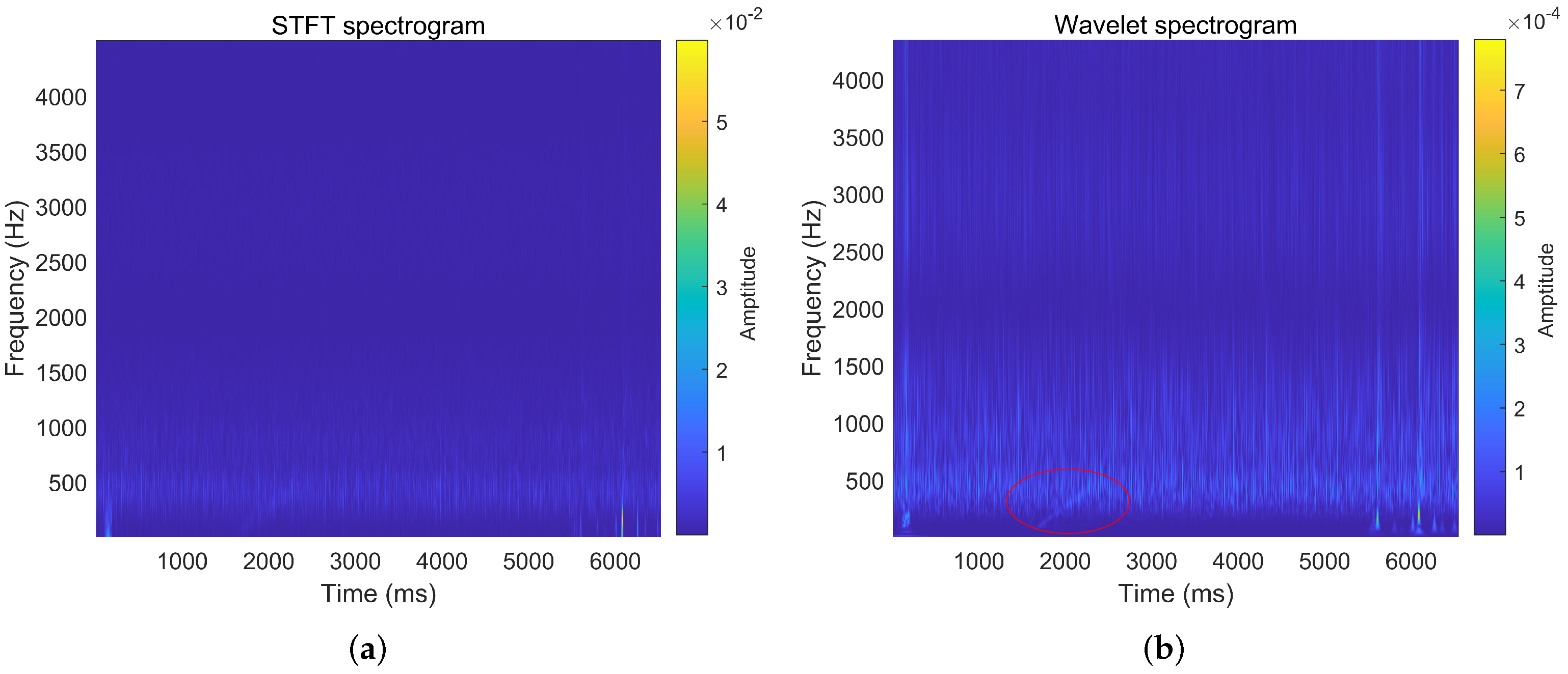 Water Surface Acoustic Wave Detection by a Millimeter Wave Radar