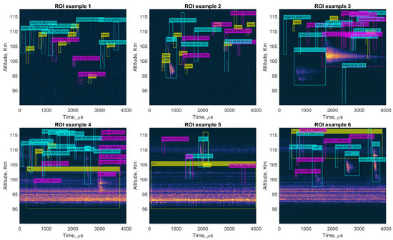 A Machine Learning Algorithm to Detect and Analyze Meteor Echoes ...