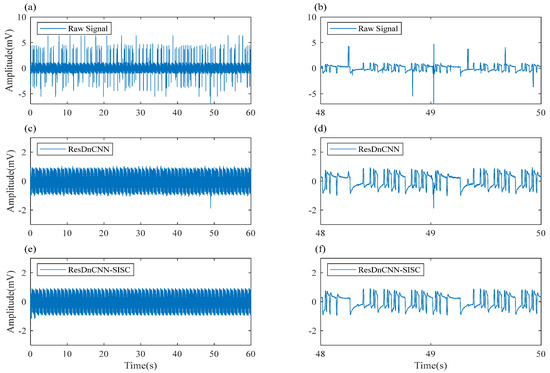 Remote Sensing | Free Full-Text | Noise Attenuation for CSEM Data via Deep Residual Denoising ...