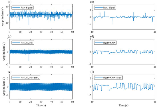 Remote Sensing | Free Full-Text | Noise Attenuation for CSEM Data via Deep Residual Denoising ...