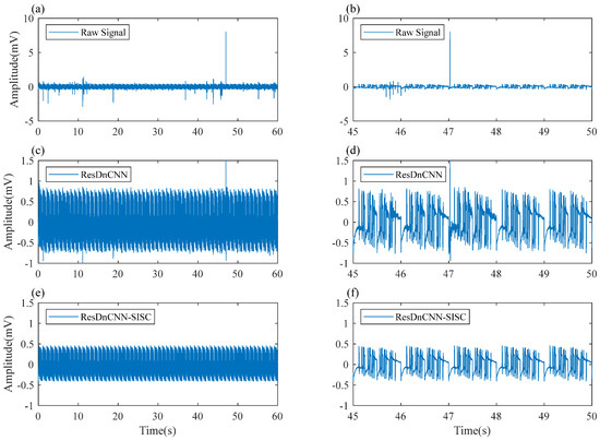 Remote Sensing | Free Full-Text | Noise Attenuation for CSEM Data via Deep Residual Denoising ...