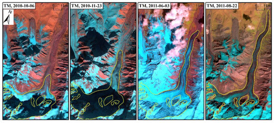 Surging Glaciers in High Mountain Asia between 1986 and 2021