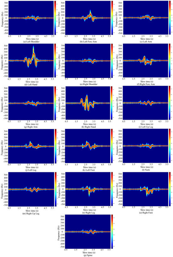 Three-Dimensional Human Pose Estimation from Micro-Doppler Signature Based on SISO UWB Radar