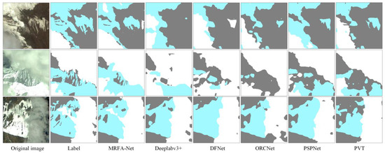 MRFA-Net: Multi-Scale Receptive Feature Aggregation Network for Cloud and Shadow Detection