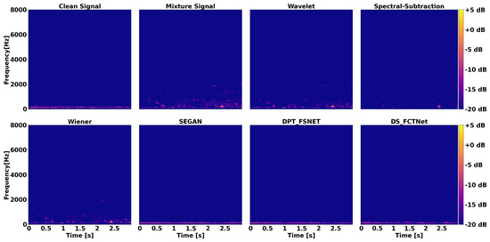 A Dual-Stream Deep Learning-Based Acoustic Denoising Model to Enhance ...