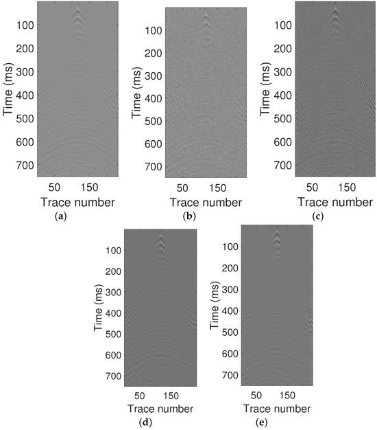 Seismic Random Noise Attenuation Using DARE U-Net