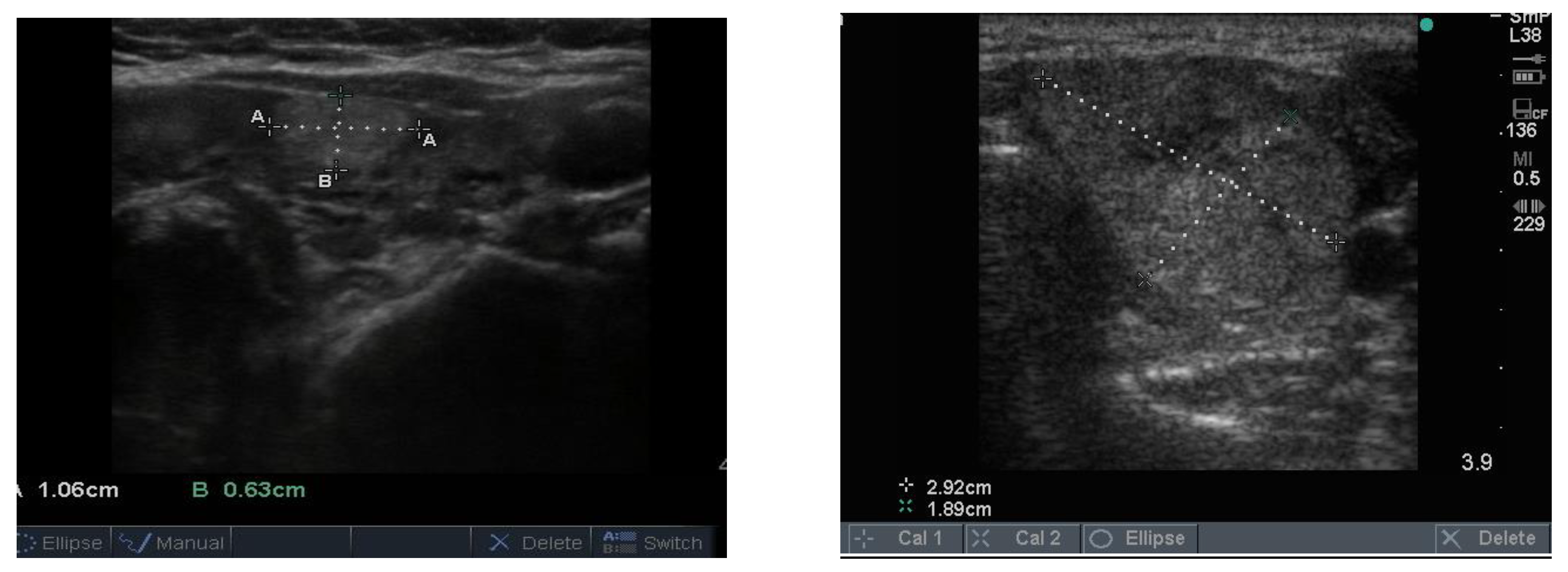 Reports Free Full Text Ultrasonographic Findings In Common Thyroid