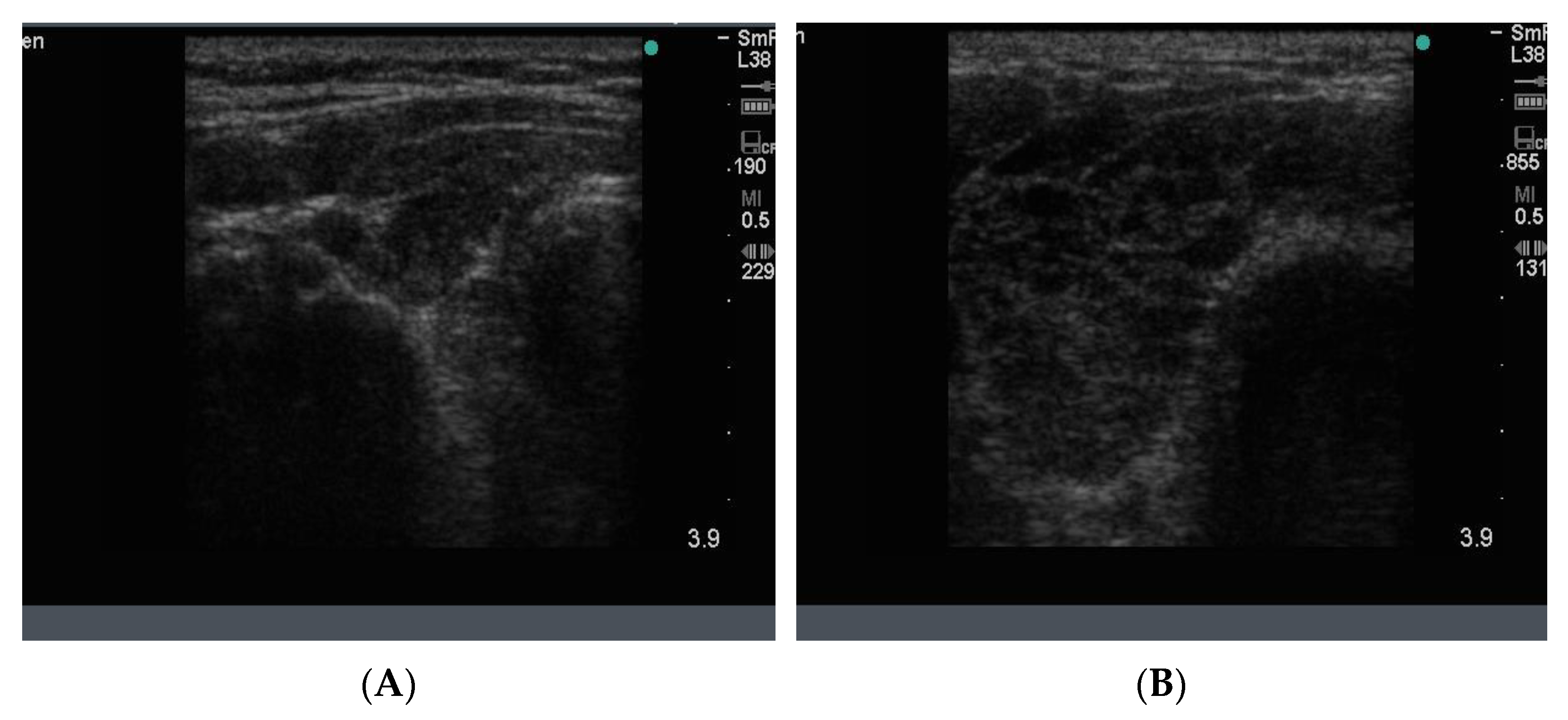 Reports Free Full Text Ultrasonographic Findings In Common Thyroid