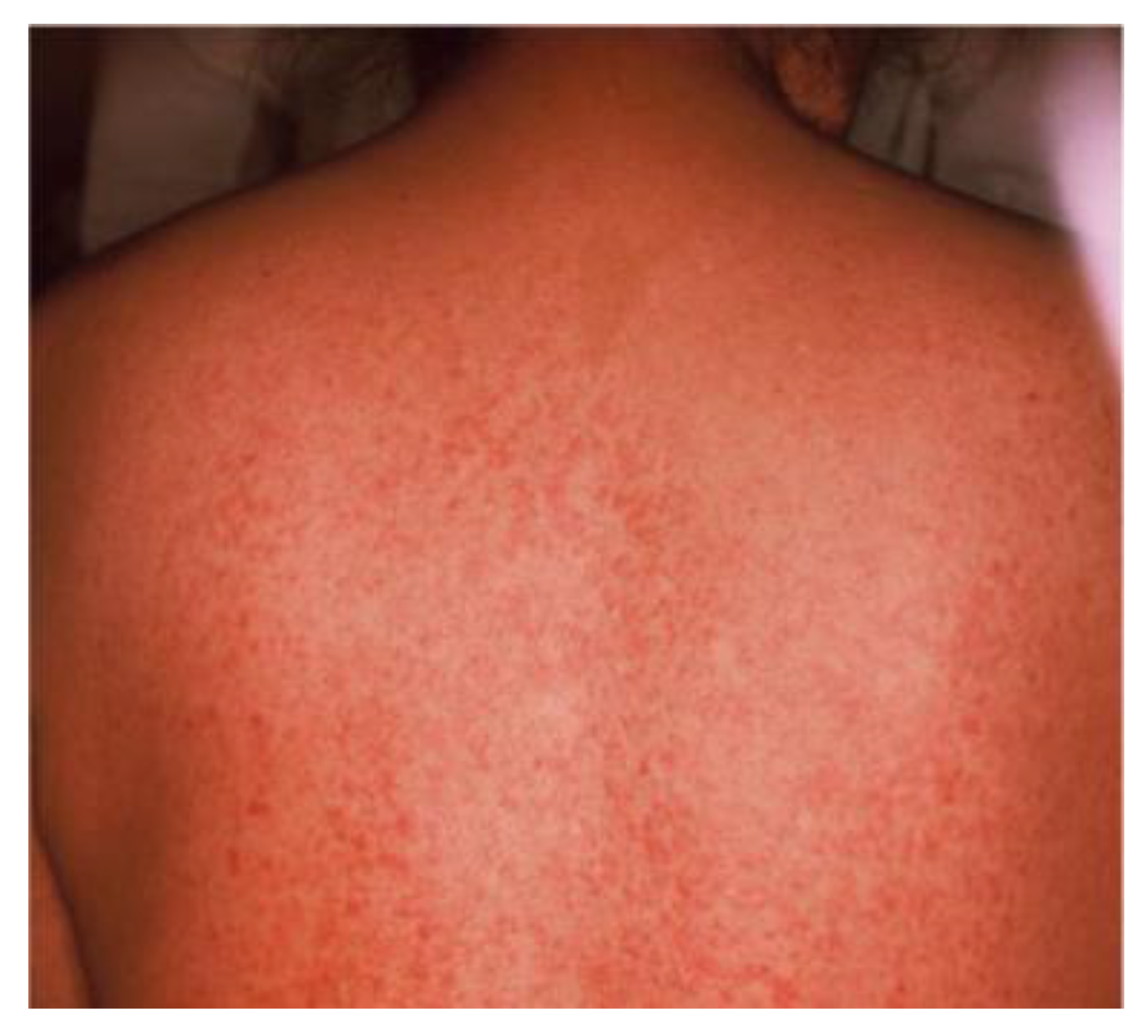 A Memorial Paper on Professor Takatsuki, Who Devoted Himself to the ...