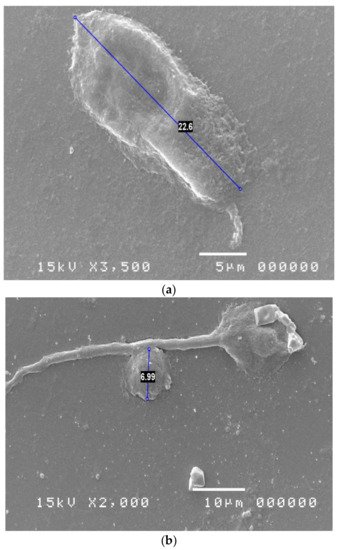 Scanning Electron Microscopy of Conjunctival Scraping: Our Experience ...