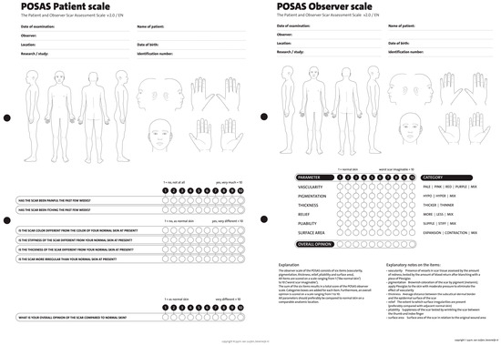 Post-Burn and Surgical Scar Reconstruction with Tissue Expanders ...