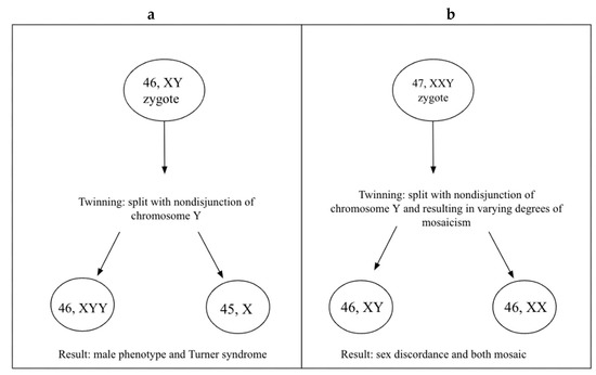 Reprod Med Free Full Text A Case Of Sex Discordant Dichorionic Diamniotic Twins After