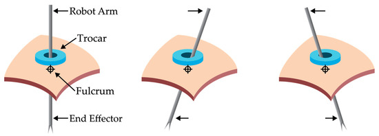 Laparoscopic Robotic Surgery: Current Perspective and Future Directions