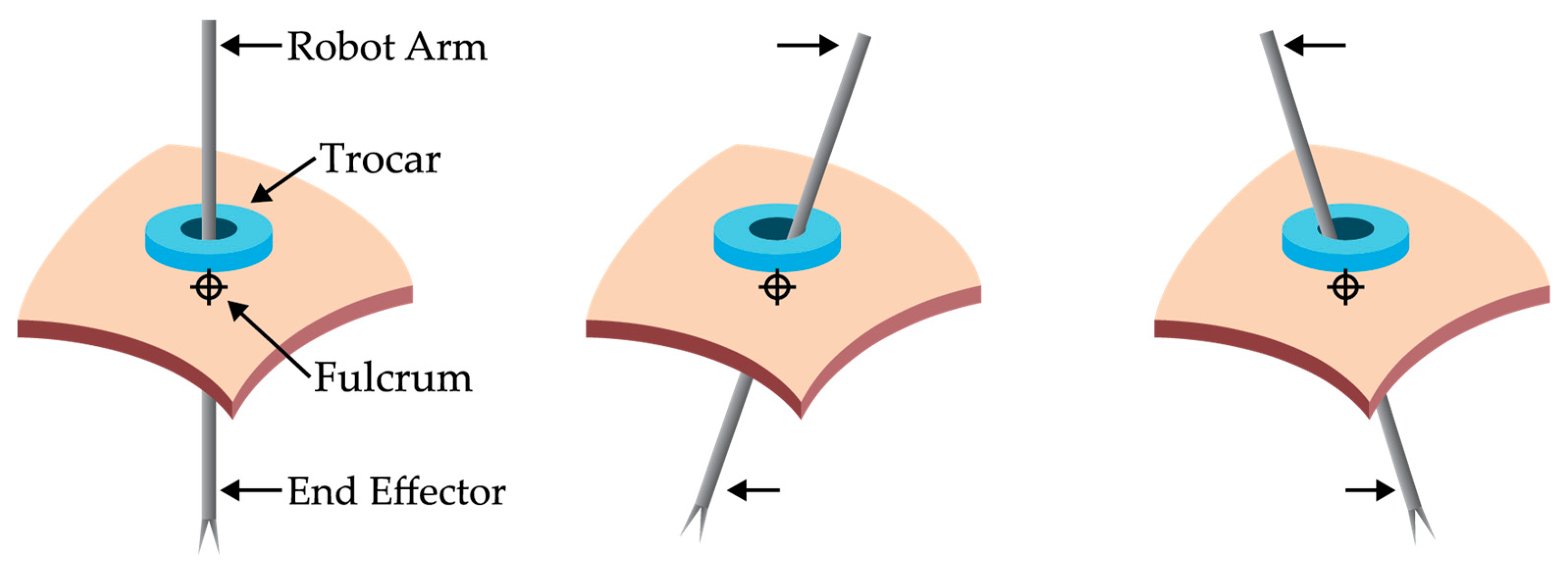 Laparoscopic Robotic Surgery: Current Perspective and Future Directions