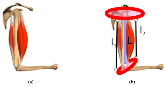 Robotics | Free Full-Text | Parallel Architectures for Humanoid Robots