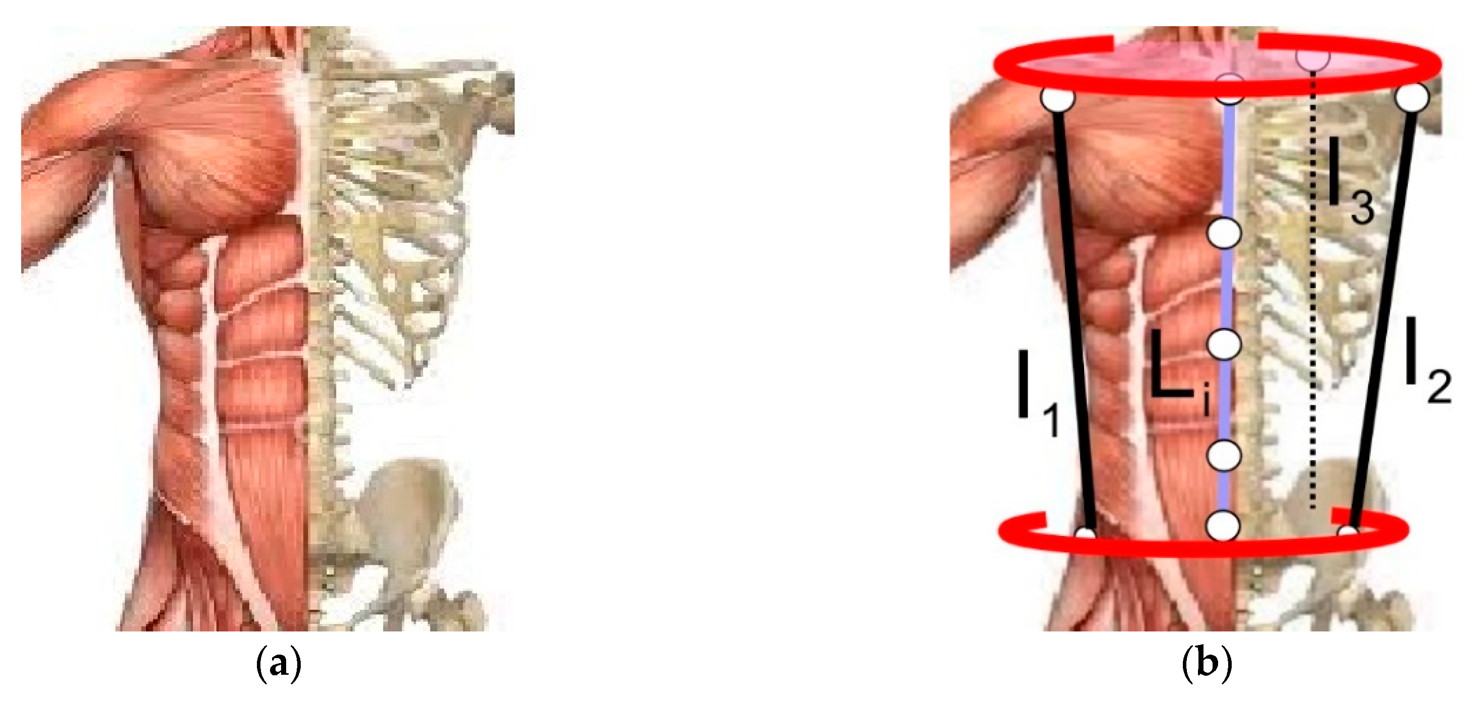 Robotics | Free Full-Text | Parallel Architectures for Humanoid Robots