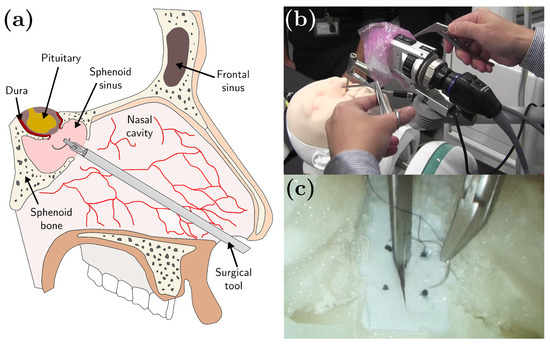 Optimization-Based Constrained Trajectory Generation for Robot-Assisted ...
