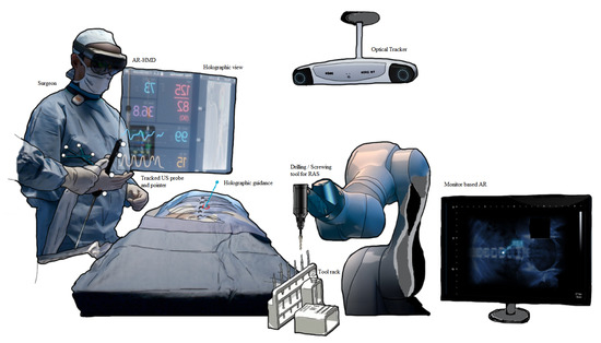 Robotics | Free Full-Text | What Is Next in Computer-Assisted Spine ...