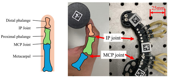 Enhanced Design of an Adaptive Anthropomorphic Finger through ...