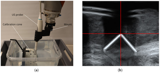 PRONOBIS: A Robotic System for Automated Ultrasound-Based Prostate ...