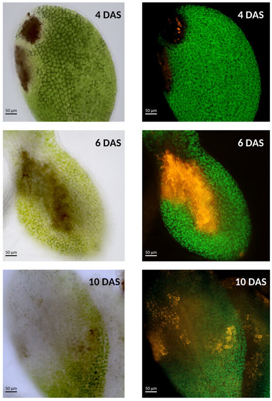 Fungal Necrotrophic Interaction: A Case Study of Seed Immune Response ...