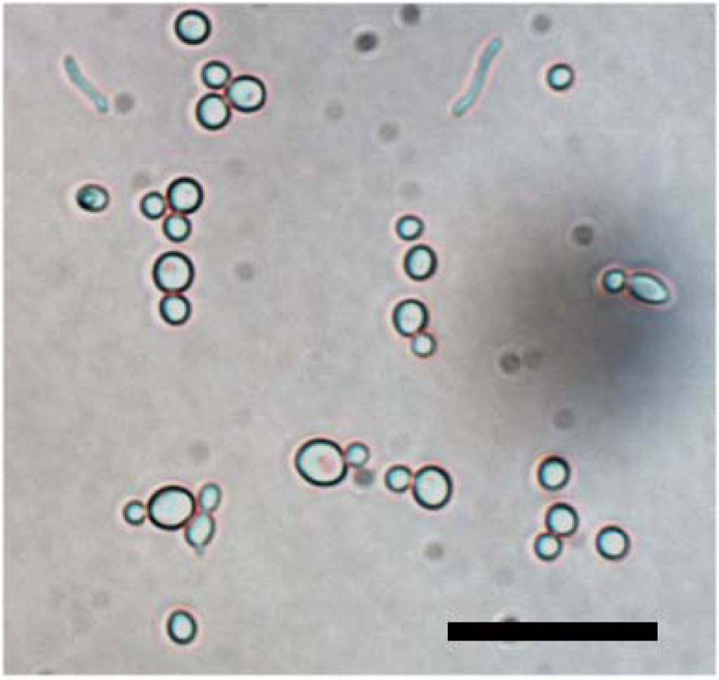 Ultra-Fast Low Concentration Detection of Candida Pathogens Utilizing ...