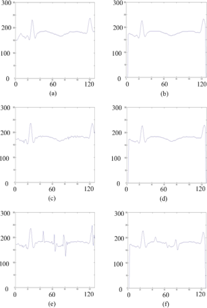 CMOS Image Sensor with a Built-in Lane Detector