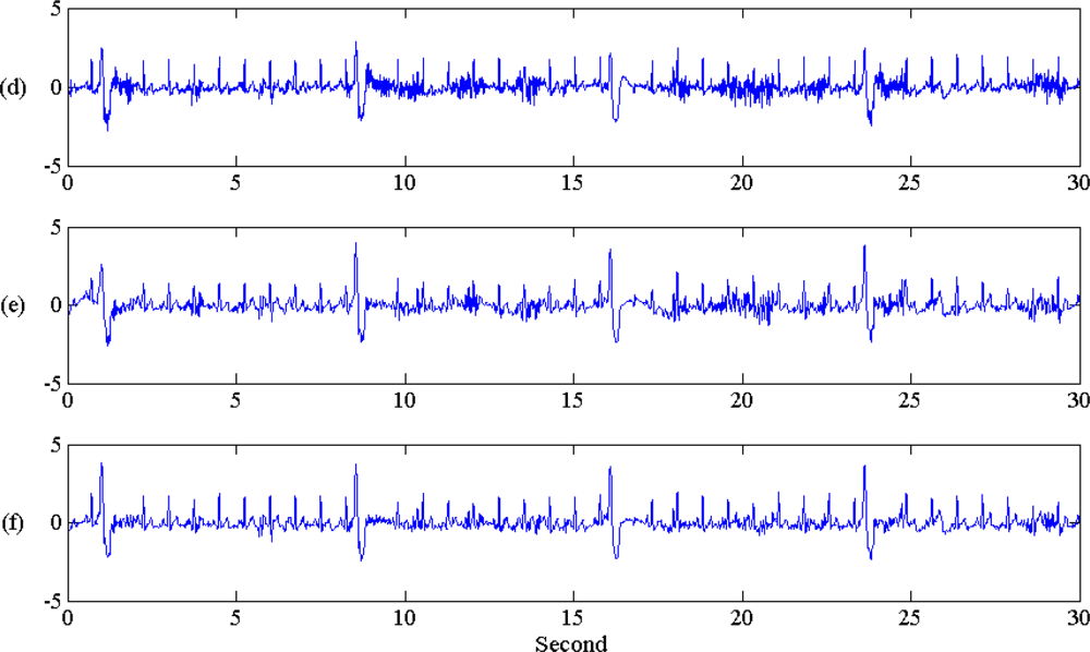Arrhythmia ECG Noise Reduction by Ensemble Empirical Mode Decomposition