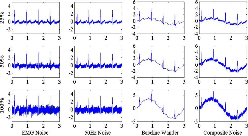 Arrhythmia ECG Noise Reduction by Ensemble Empirical Mode Decomposition
