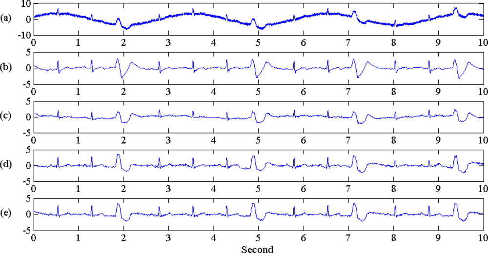 Arrhythmia ECG Noise Reduction by Ensemble Empirical Mode Decomposition