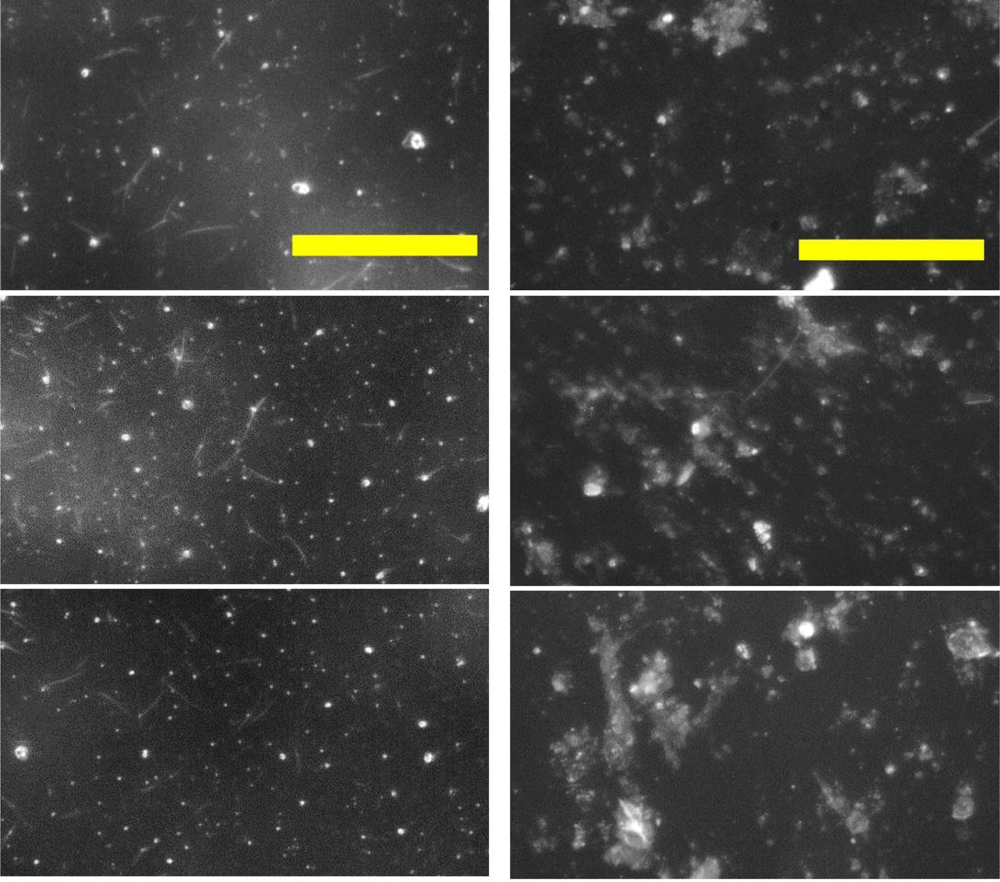 Automated Counting of Airborne Asbestos Fibers by a High-Throughput ...
