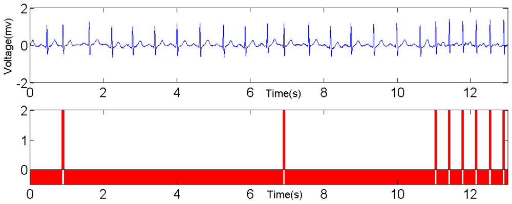 Sensors | Free Full-Text | A Real-Time Cardiac Arrhythmia ...