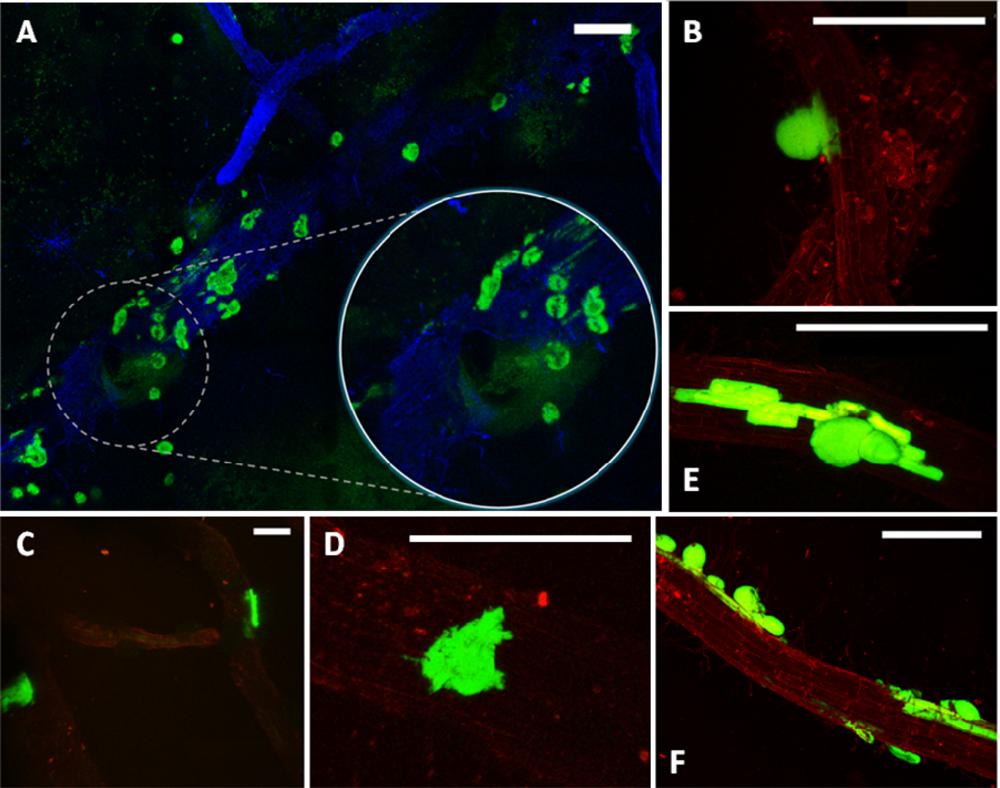 Colonization of Potato Rhizosphere by GFP-Tagged Bacillus subtilis MB73 ...