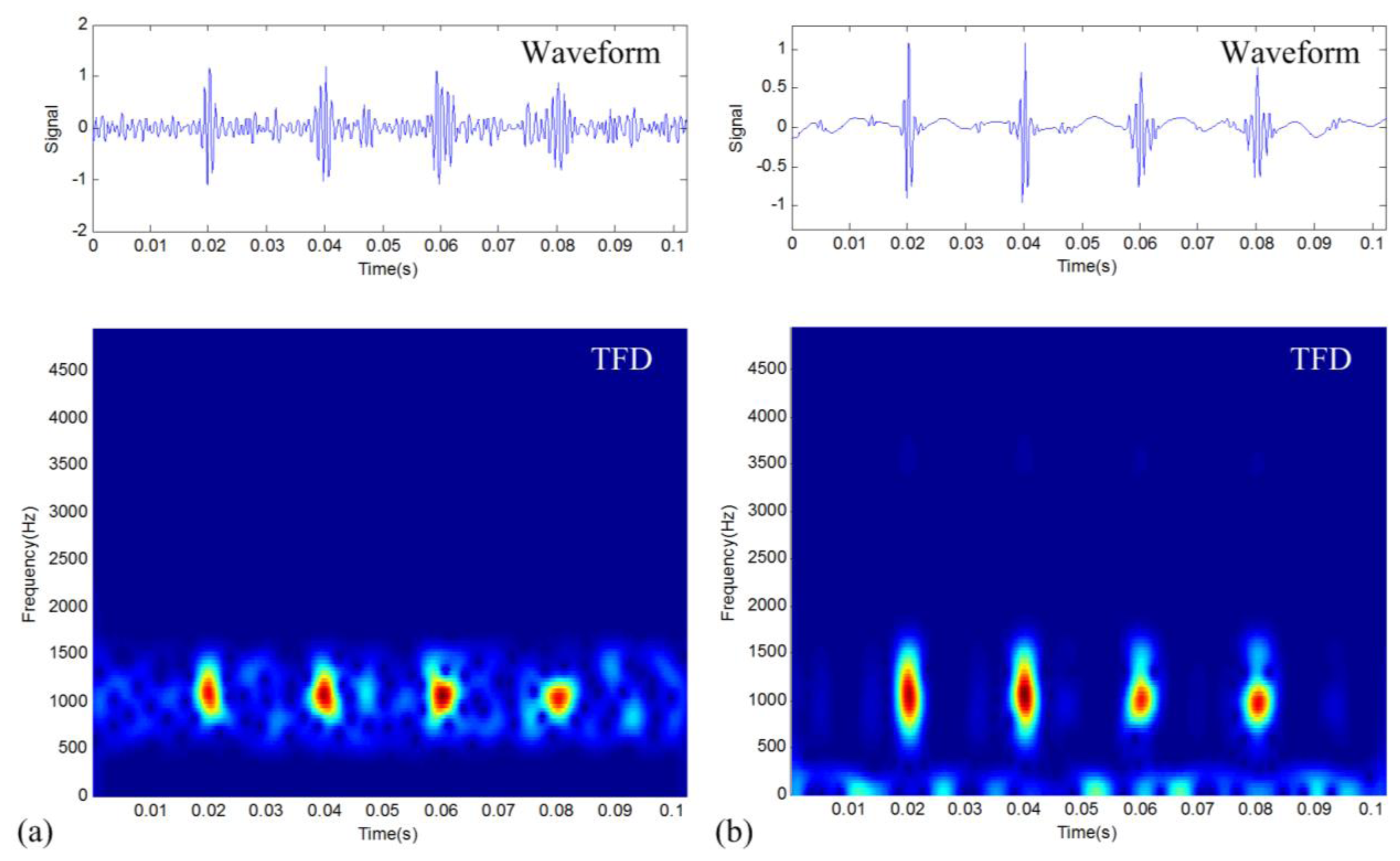 Sensors | Free Full-Text | Vibration Sensor Data Denoising Using a Time ...