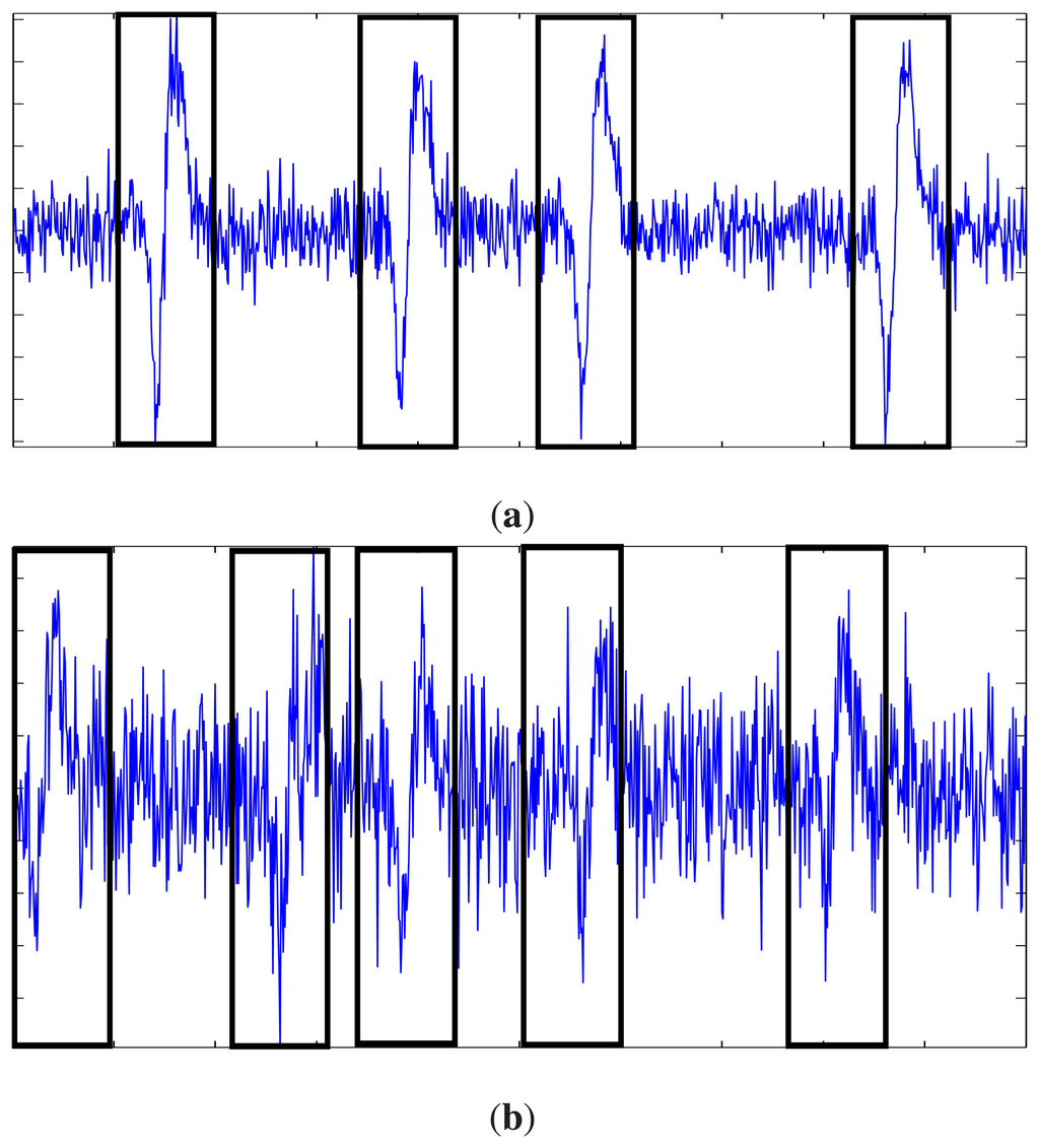 Sensors Free Full Text Spike Detection Based On Normalized Correlation With Automatic