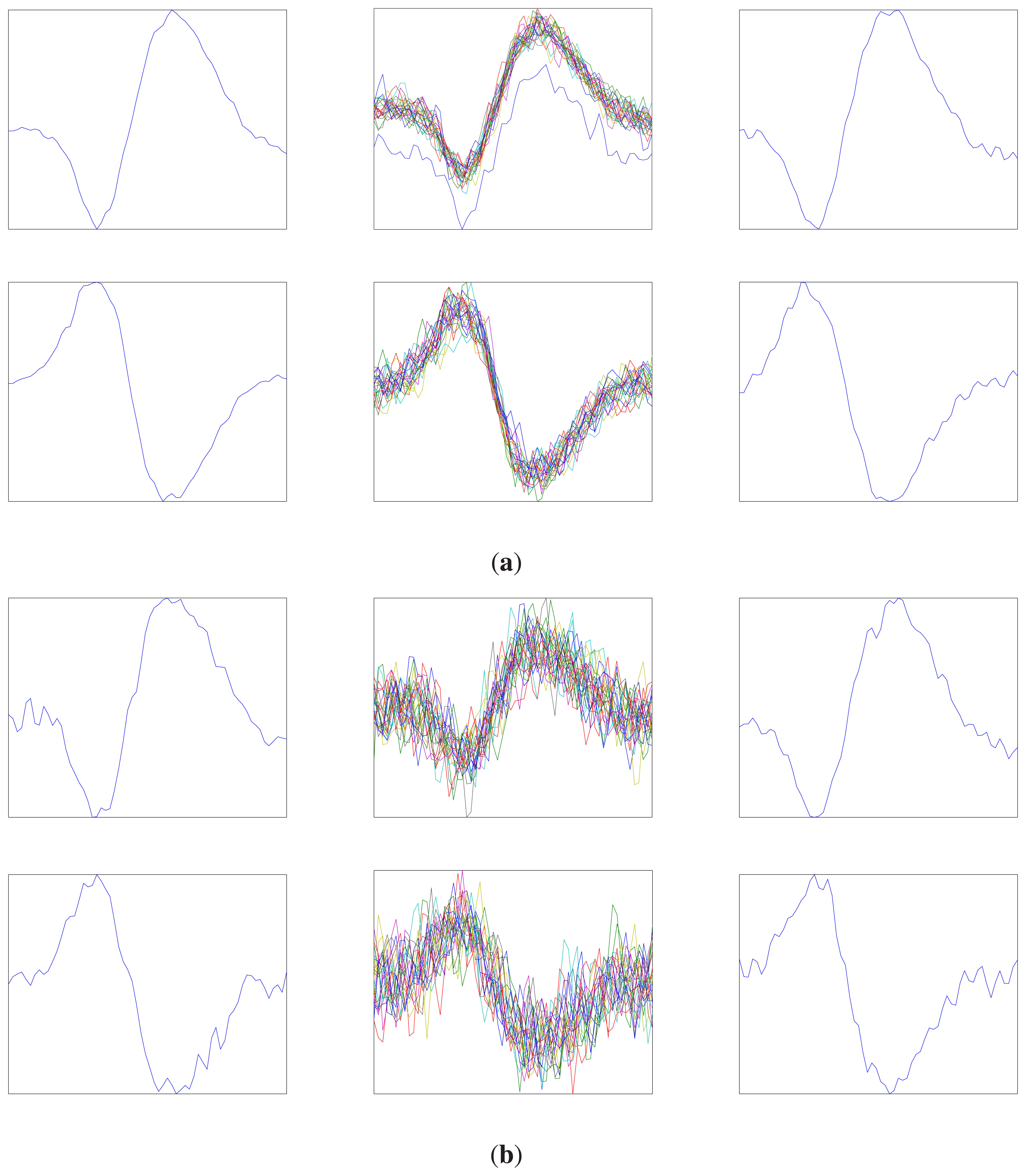 Sensors | Free Full-Text | Spike Detection Based on Normalized ...