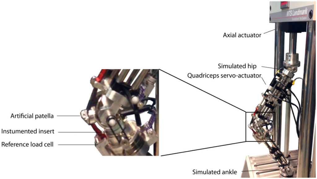 Enclosed Electronic System for Force Measurements in Knee Implants
