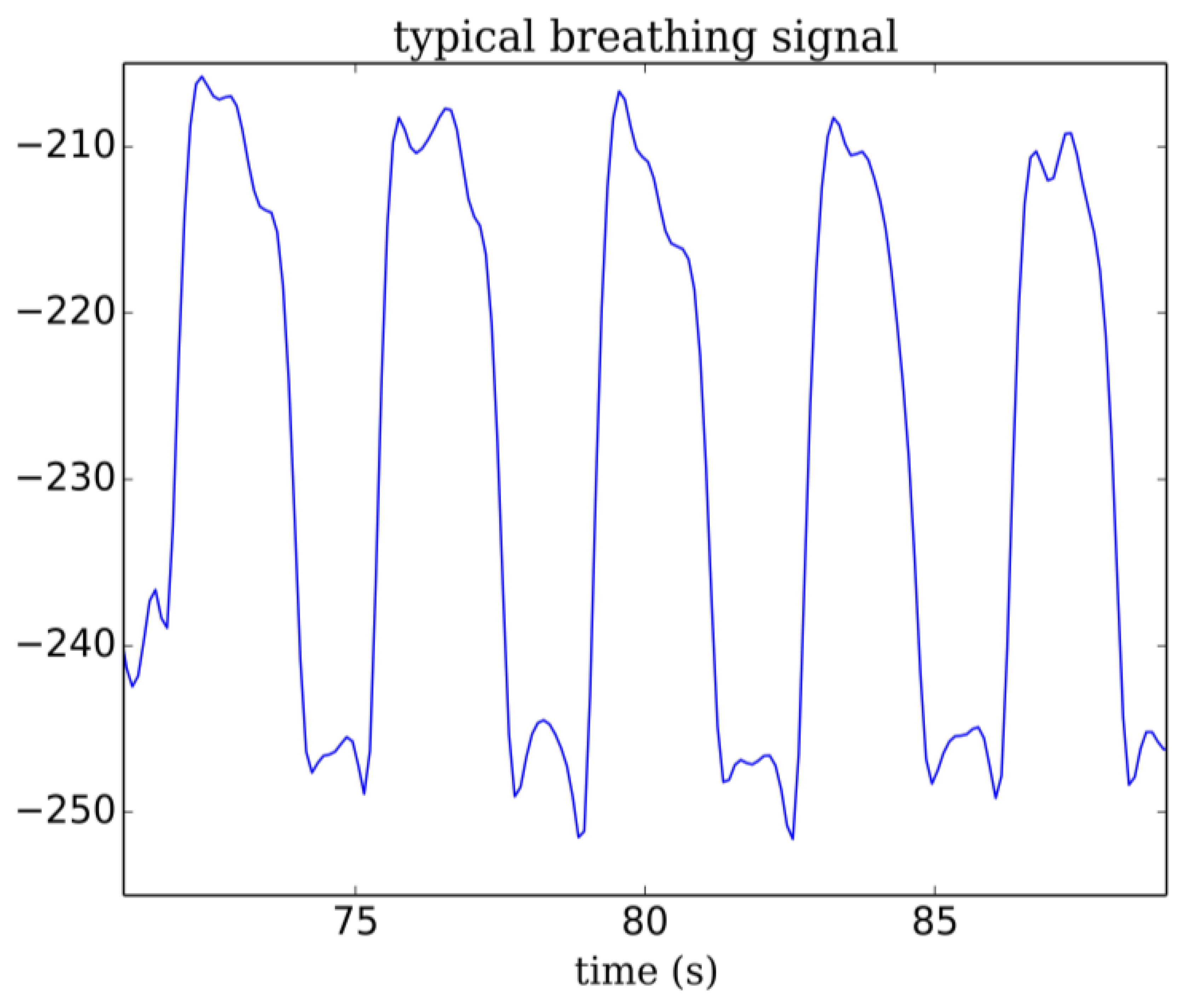 An Ultrasonic Contactless Sensor for Breathing Monitoring