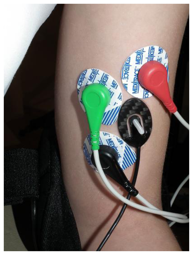 In-Vivo Measurement of Muscle Tension: Dynamic Properties of the MC ...