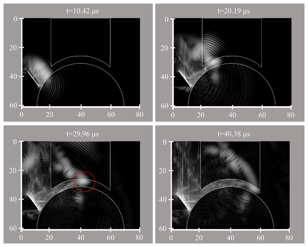 A Novel Ultrasound Technique for Detection of Osteochondral Defects in ...