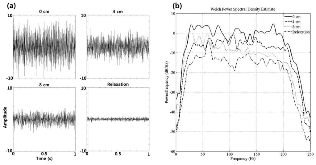 Sensors | Free Full-Text | A Real-Time Pinch-to-Zoom Motion Detection ...