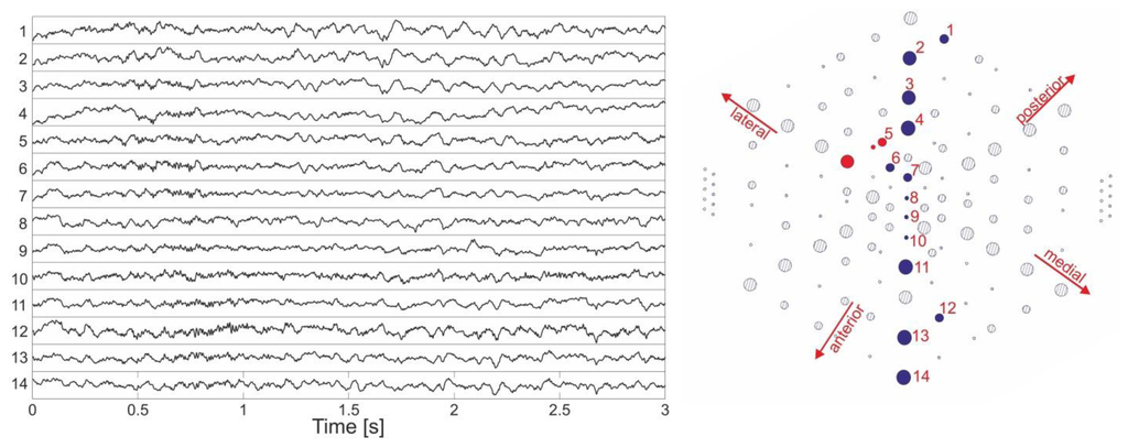 A Multi-Channel, Flex-Rigid ECoG Microelectrode Array for Visual Cortical Interfacing