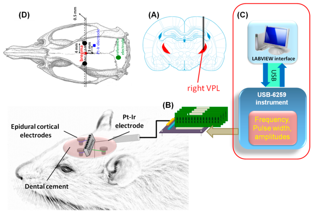 A Programmable High-Voltage Compliance Neural Stimulator for Deep Brain ...