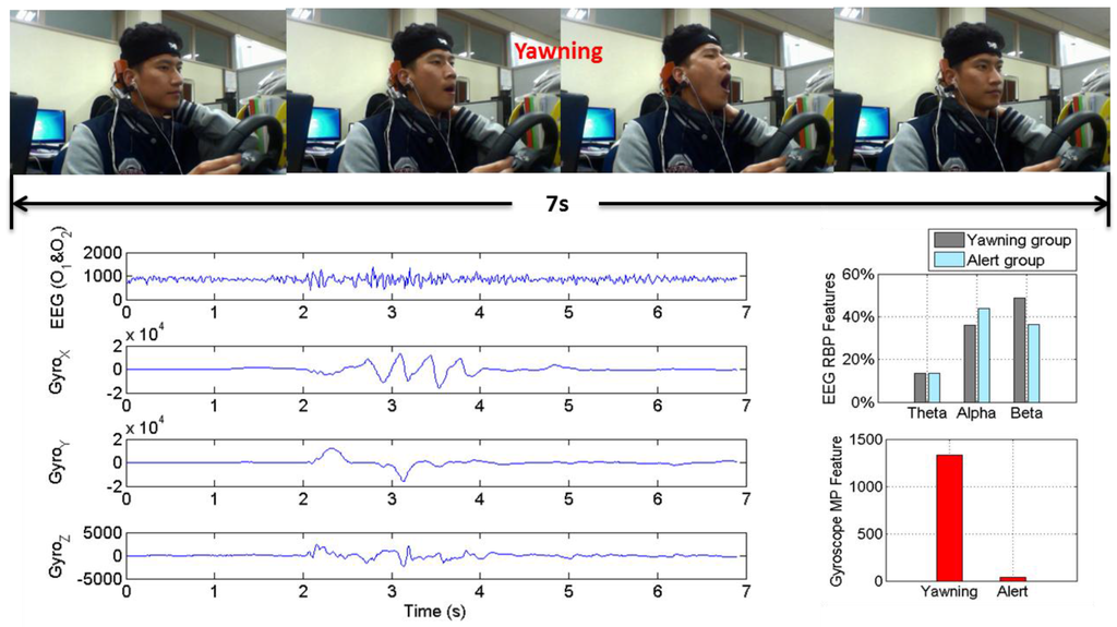 Sensors | Free Full-Text | A Context-Aware EEG Headset System for Early ...