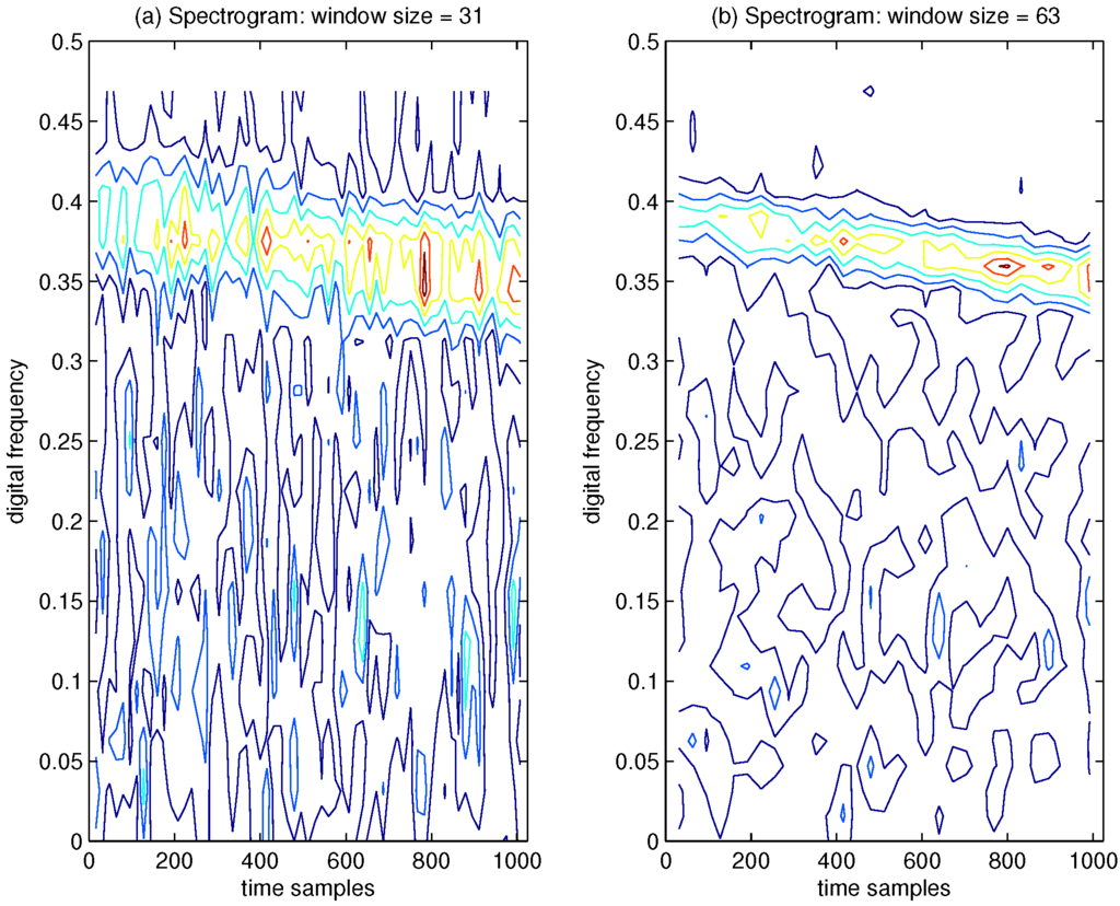 Sensors | Free Full-Text | A New Reassigned Spectrogram Method in ...