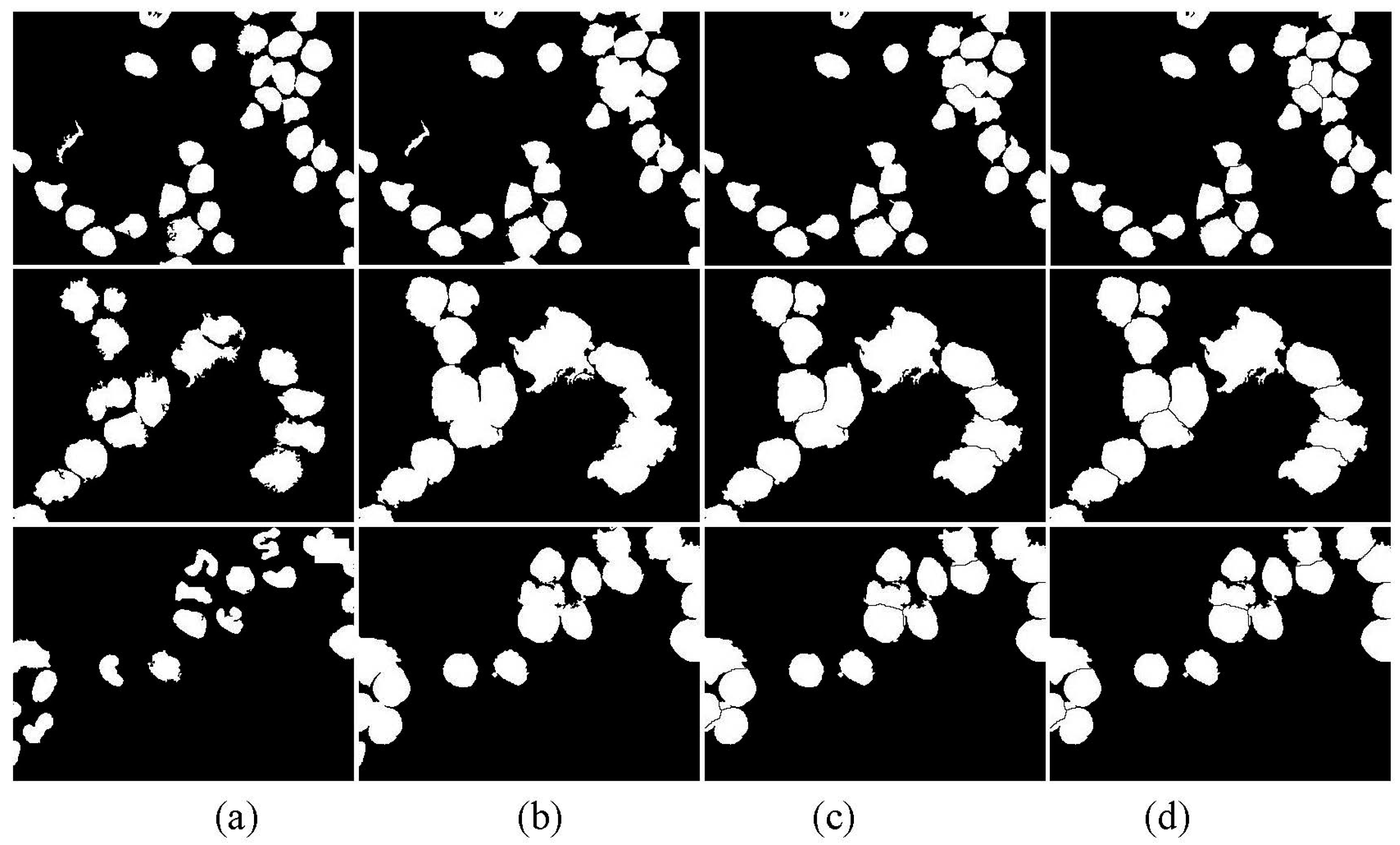 Sensors | Free Full-Text | Segmentation of White Blood Cells through ...